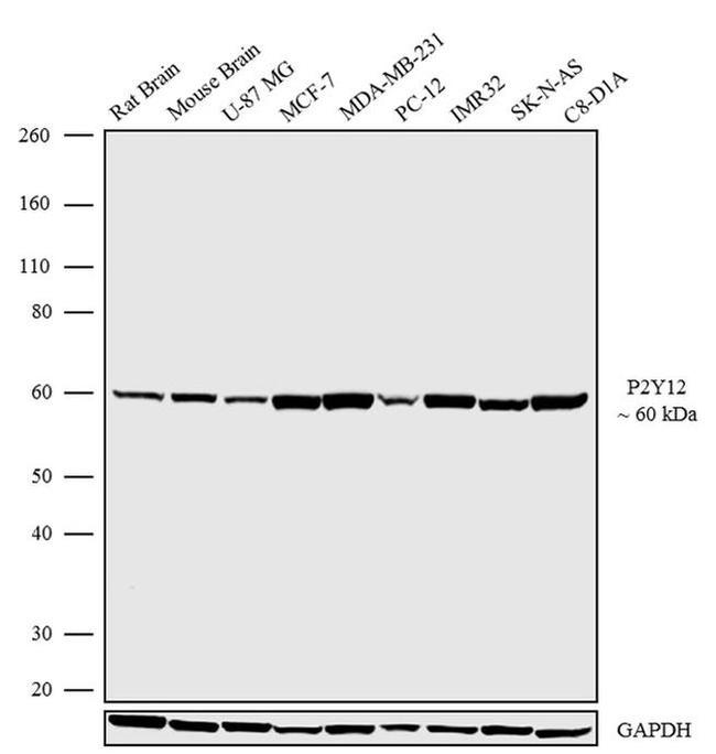 P2Y12 Recombinant Monoclonal Antibody (4H5L19) (702516)