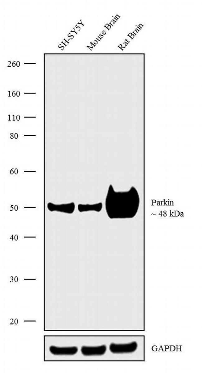 Parkin Recombinant Monoclonal Antibody (21H24L9) (702785)