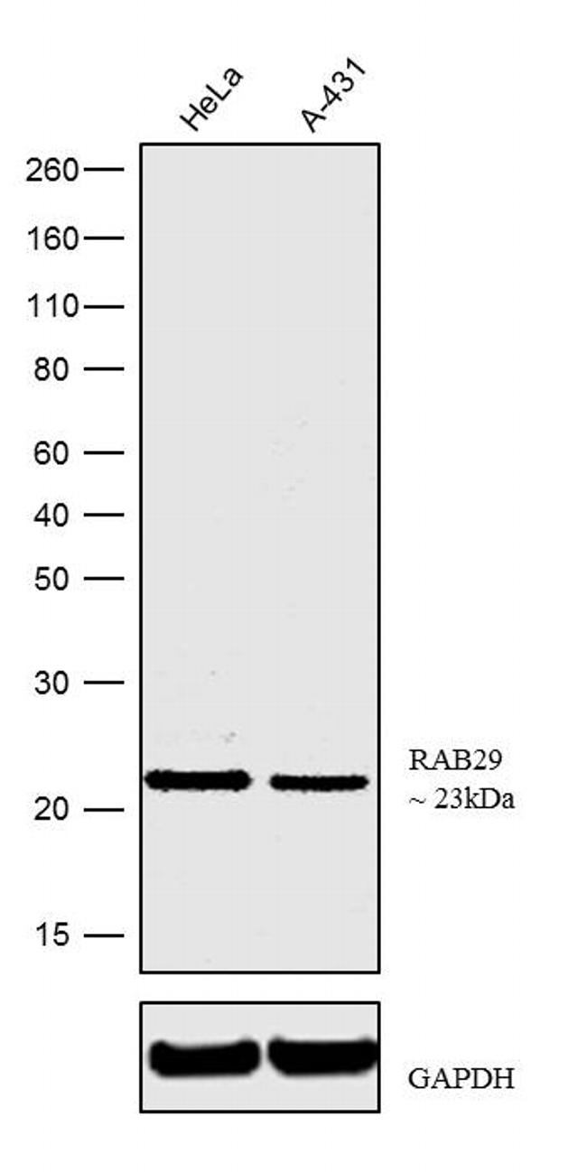 RAB29 Antibody (703807)
