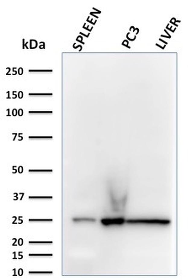 C1QA/Complement C1q A-Chain Antibody (712-MSM1-P1)