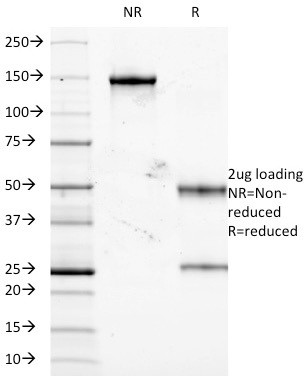 TNF-alpha (Tumor Necrosis Factor alpha) Monoclonal Antibody (J2D10) (7124-MSM4-P0)