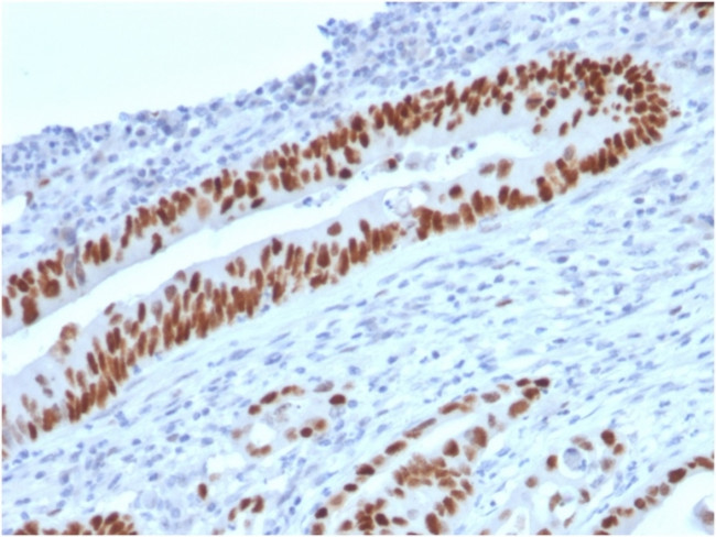 p53 (Tumor Suppressor Protein) Monoclonal Antibody (TP53/2719) (7157 ...