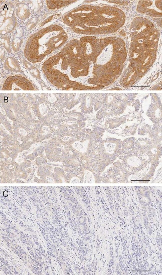 FHIT Antibody (71-9000)