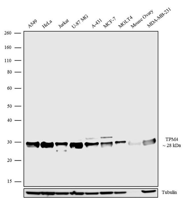 TPM4 Antibody (720311)