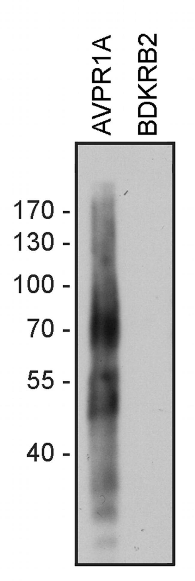 AVPR1A Antibody (720364)