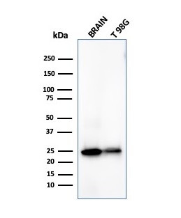 PGP9.5/UchL1 (pan-Neuronal Marker) Monoclonal Antibody (UCHL1/4558 ...