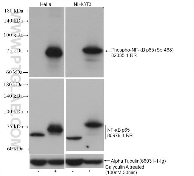 Phospho-NF-kB p65 (Ser468) Recombinant Monoclonal Antibody (6N1) (82335-1-RR)