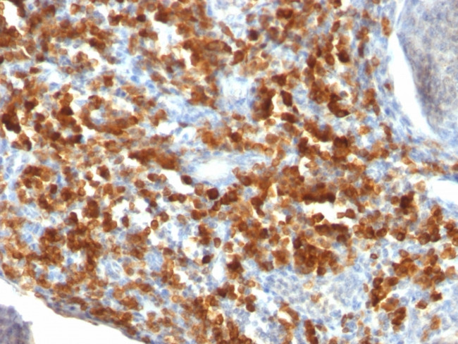 CD79a (B-Cell Marker) Monoclonal Antibody (IGA/515) (973-MSM5-P1ABX)