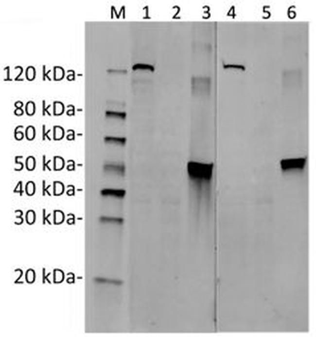 SaCas9 Monoclonal Antibody (26H10) (A01952-40)