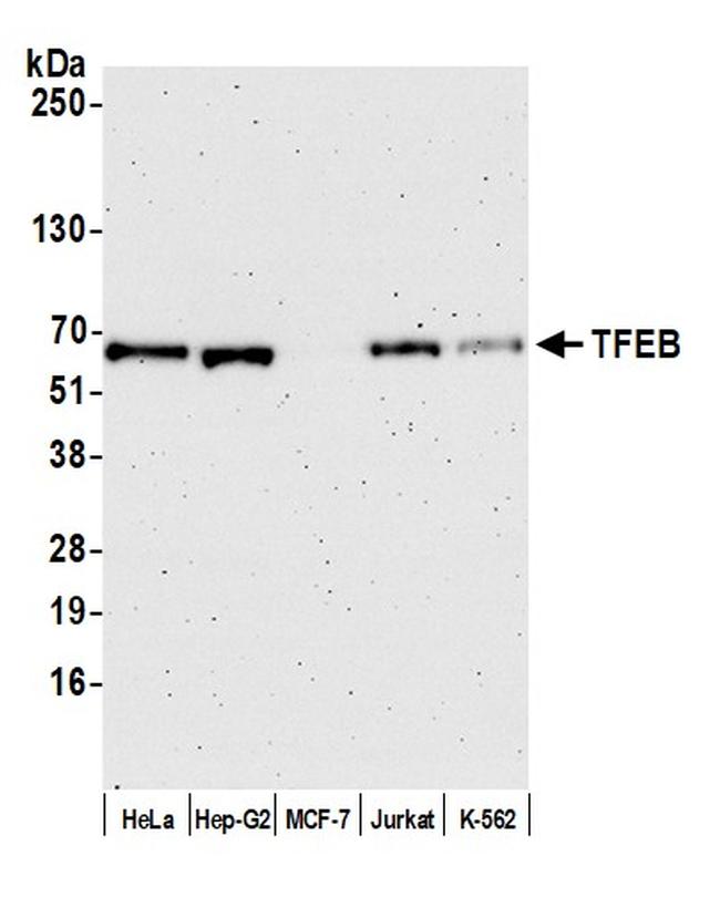 TFEB Polyclonal Antibody (A303-673A)