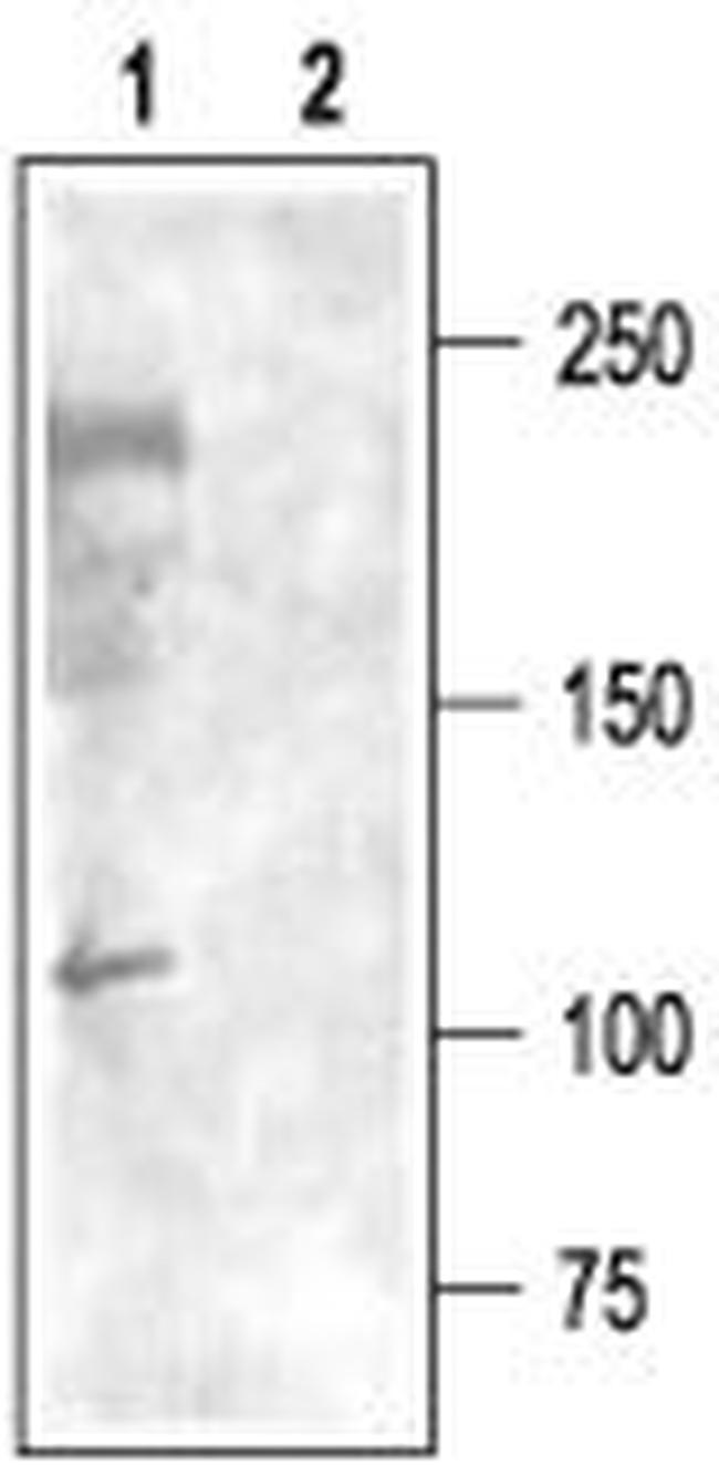 CaV3.3 (CACNA1I) Polyclonal Antibody (ACC-009-200UL)