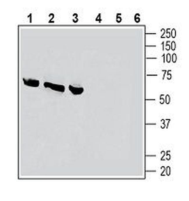 CRLR/CALCRL (extracellular) Polyclonal Antibody (ACR-060-200UL)