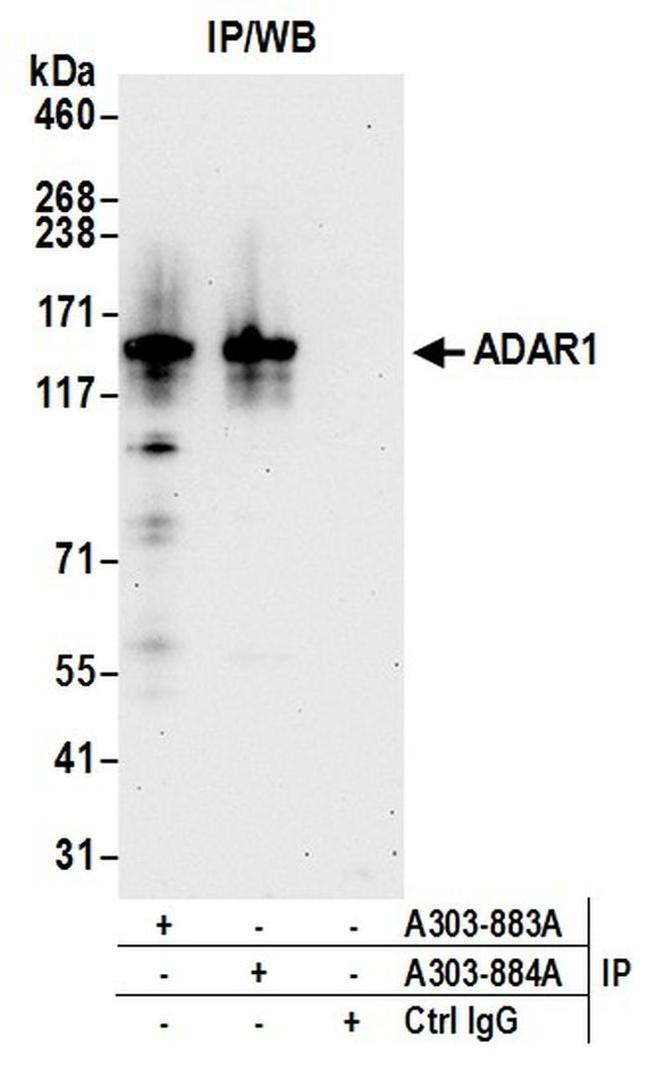 ADAR1 Antibody (A303-883A)
