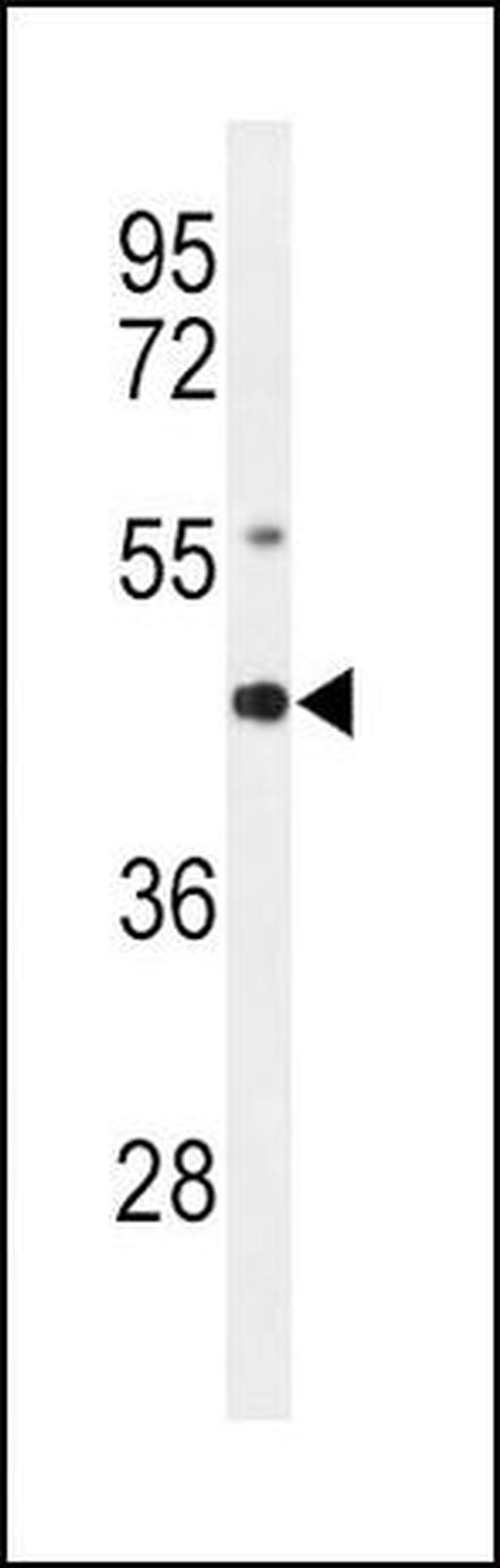 RAGE Antibody (PA5-24787)