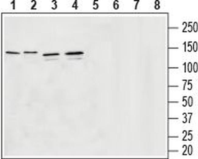 Vesicular GABA Transporter (VGAT) Polyclonal Antibody (AGT-005-GP200UL)