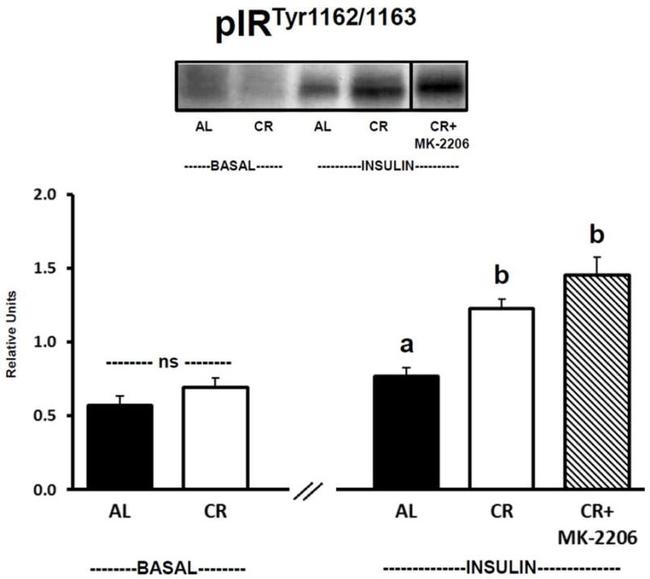 INSR beta Antibody (AHR0271)