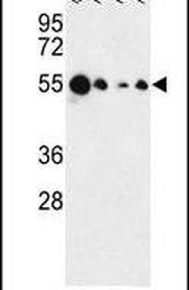 AIM2 Antibody (PA5-26874)