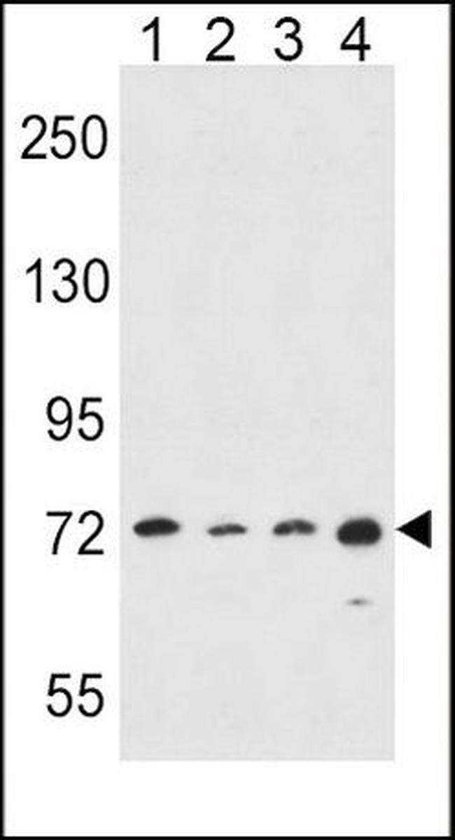 ALOX15 Antibody (PA5-15065)