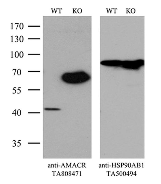 AMACR Antibody (CF808471)