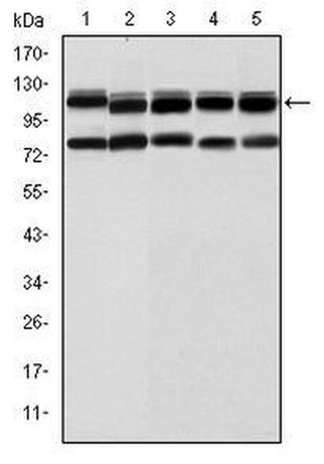 BMPR2 Monoclonal Antibody (1F12) (MA5-15826)