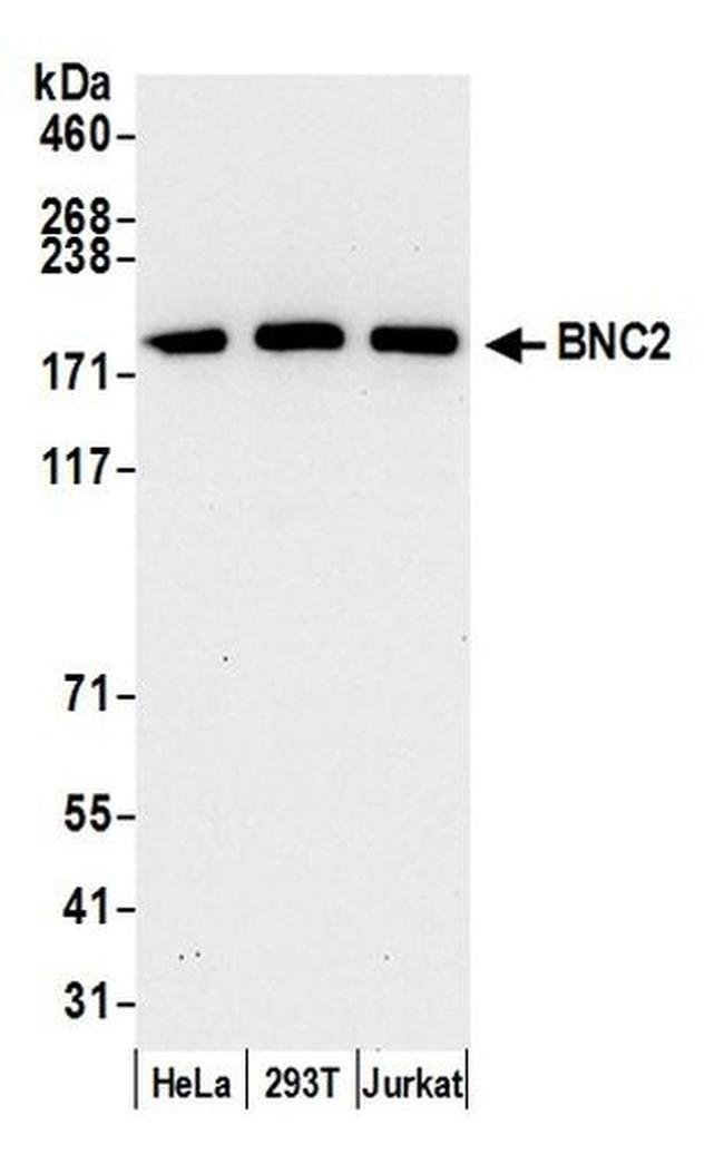 BNC2 Polyclonal Antibody (A305-487A-T)