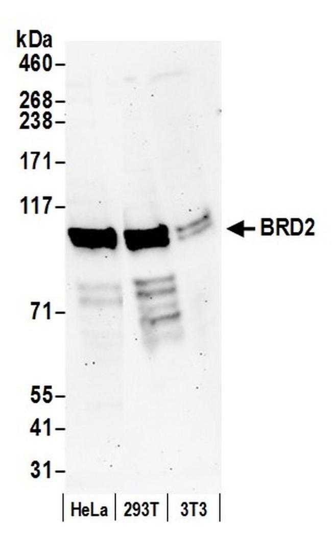 BRD2 Polyclonal Antibody (A302-583A)