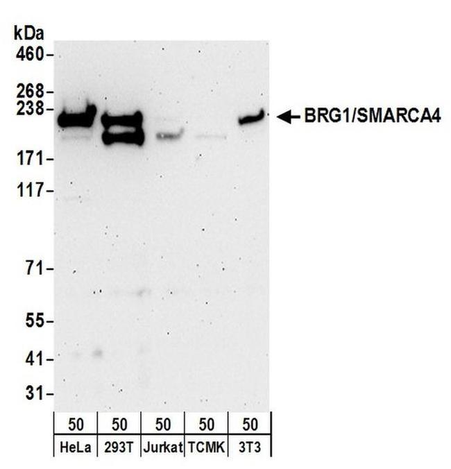 BRG1/SMARCA4 Antibody (A300-813A)
