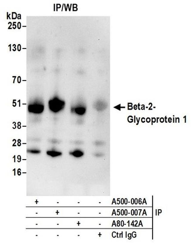 Beta-2-Glycoprotein 1 Monoclonal Antibody (7B8) (A500-007A)