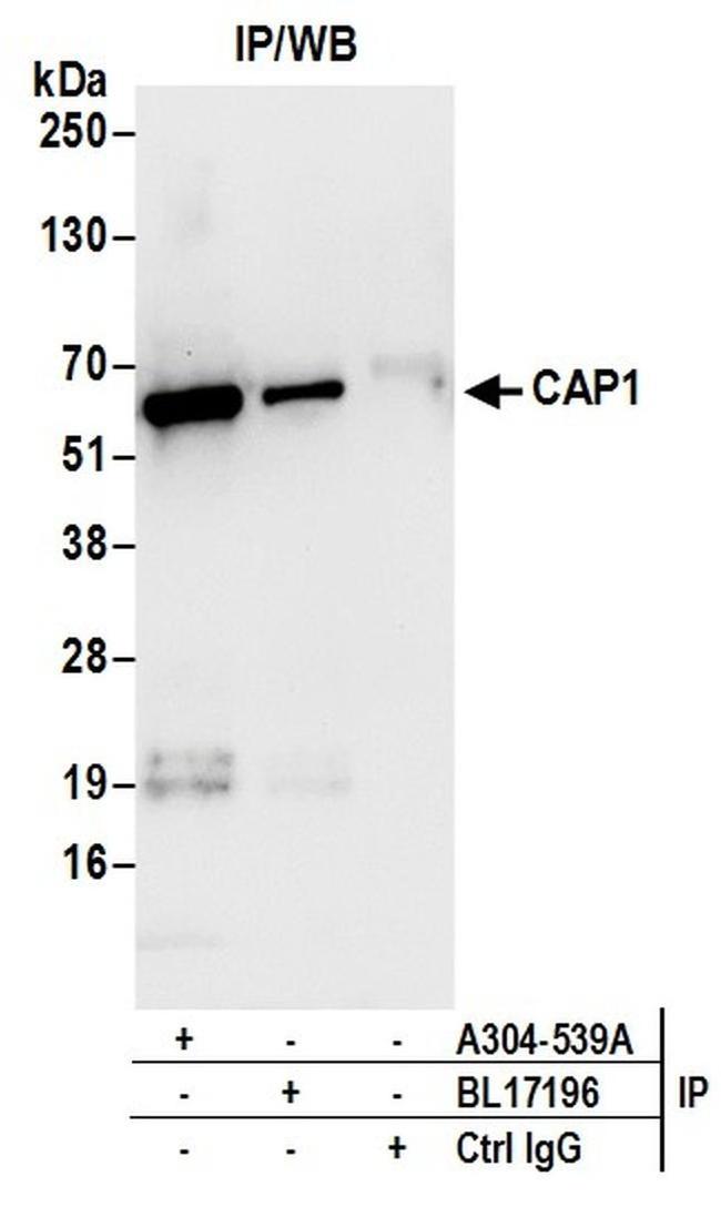 CAP1 Antibody (A304-539A)
