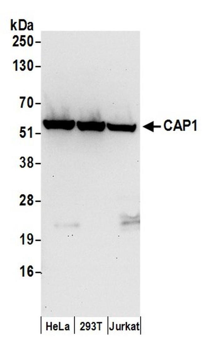 CAP1 Antibody (A304-539A)
