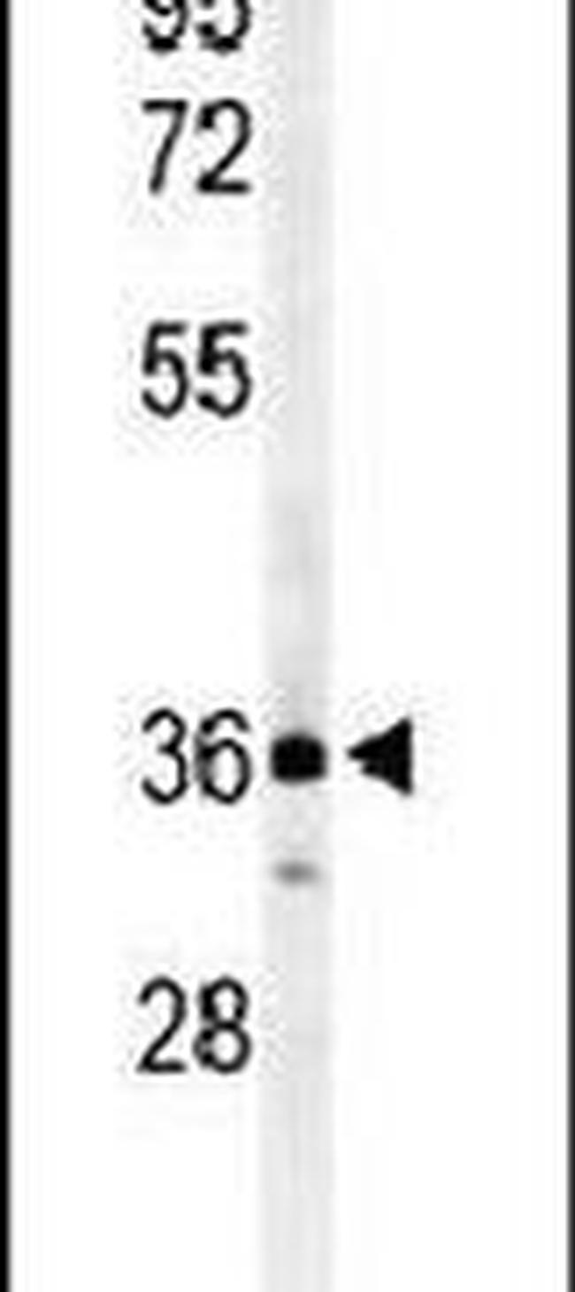 CCR1 Antibody (PA5-24785)