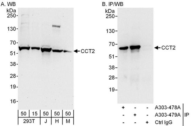 CCT2 Antibody (A303-478A)