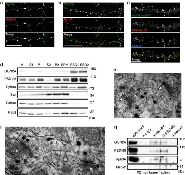 NMDAR2A Antibody (480031)