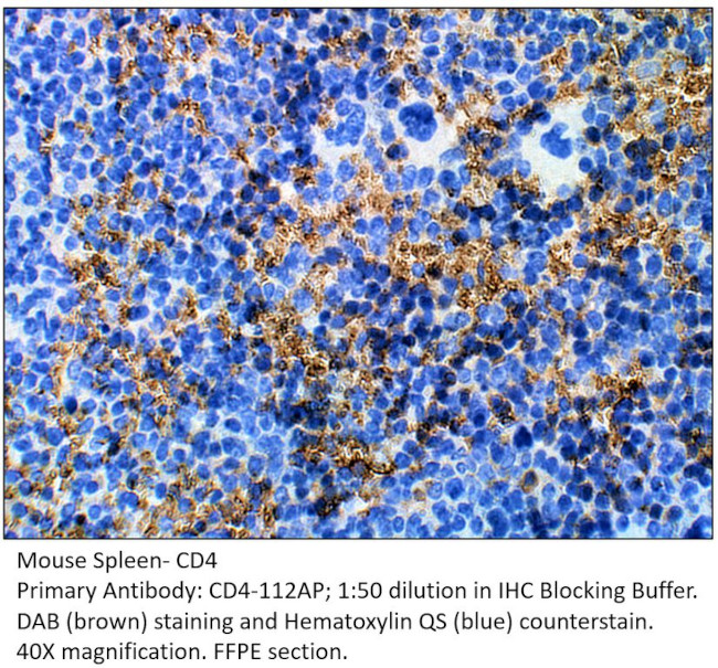 CD4 Polyclonal Antibody (CD4-112AP)