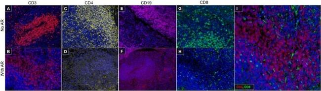 CD4 Antibody, eFluor™ 450 (48-0041-82)