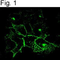 CFTR Antibody (PA1-935)