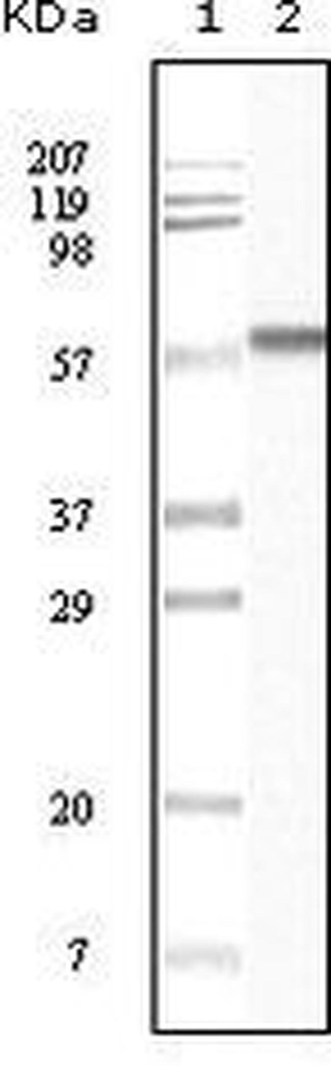 CK1 alpha Antibody (MA5-15300)