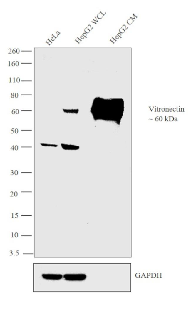 Vitronectin Monoclonal Antibody (HV2) (CSI 003-02-02)