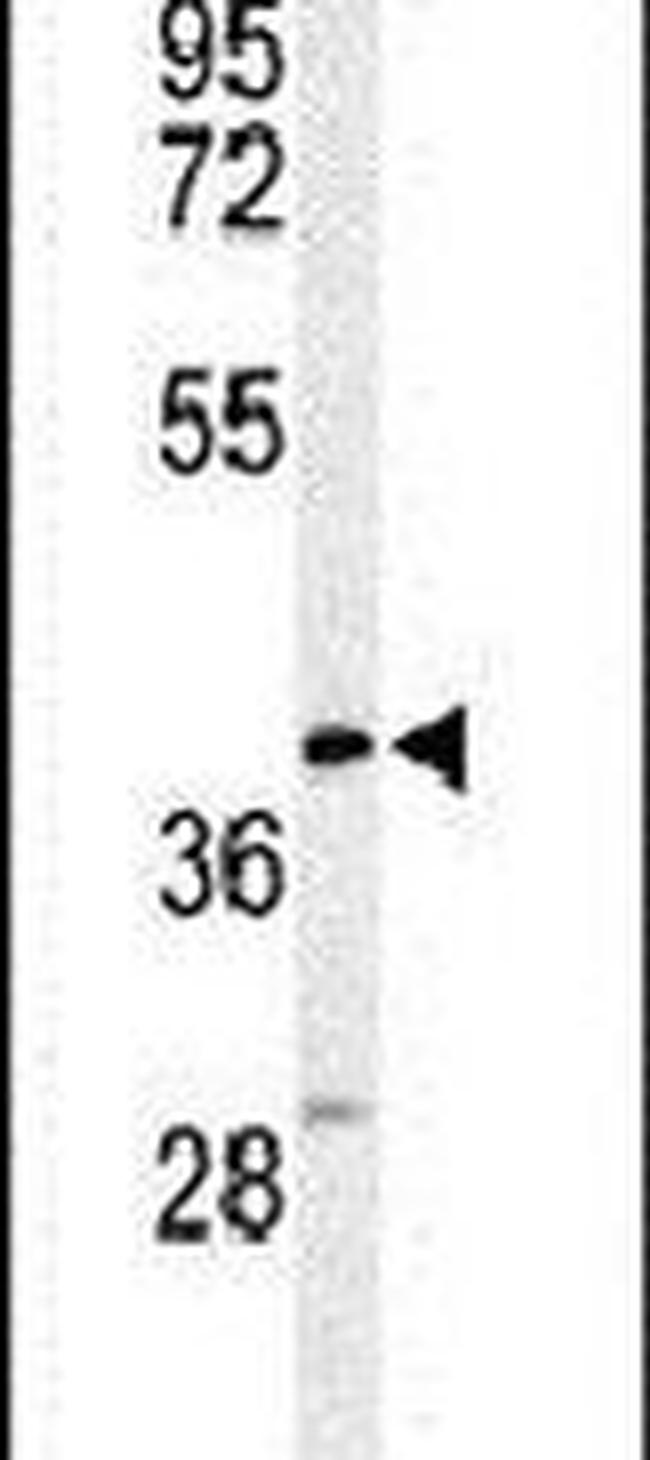 MT-CYB Antibody (PA5-26626)