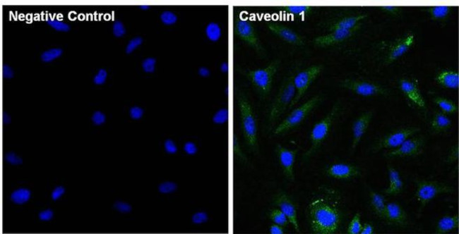 Caveolin 1 Antibody (MA3-600)