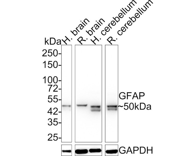 GFAP Monoclonal Antibody (1-D4) (EM140707)