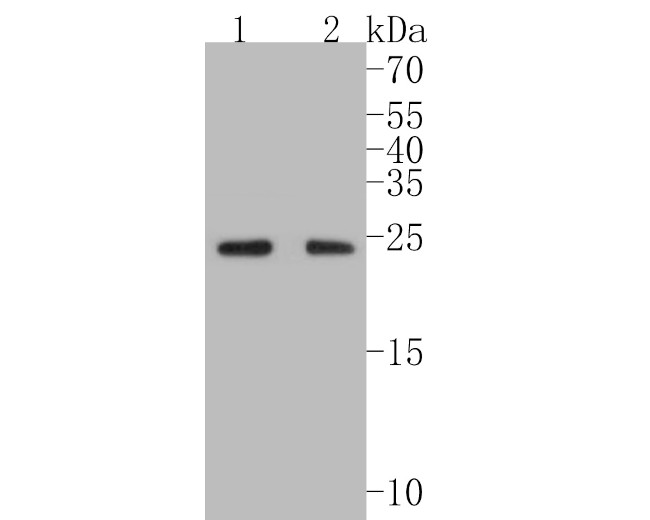 Bcl-2 Monoclonal Antibody (9F3) (EM1701-83)
