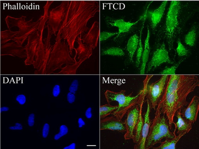 FTCD Antibody (UM500088CF)