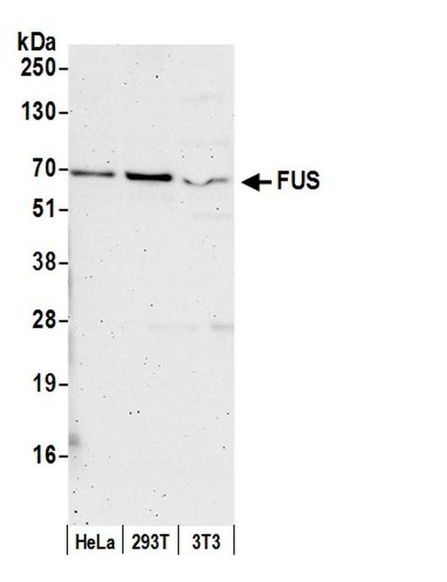 FUS Polyclonal Antibody (A300-292A-T)