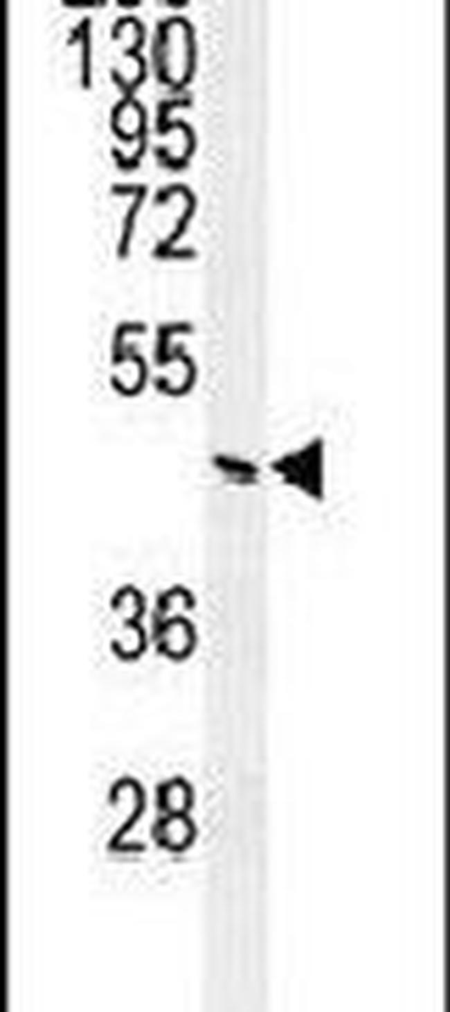 G6PC Antibody (PA5-25148)
