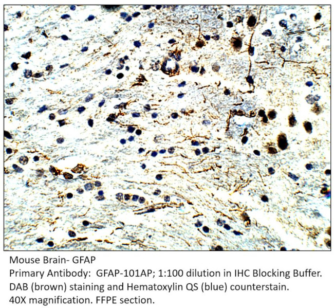 GFAP Polyclonal Antibody (GFAP-101AP)