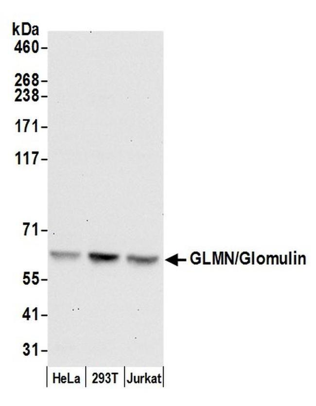 GLMN/Glomulin Polyclonal Antibody (A304-960A-T)