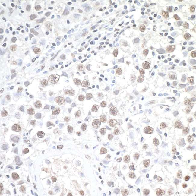 Phospho-gamma-H2AX (Ser139) Antibody (A300-081A)