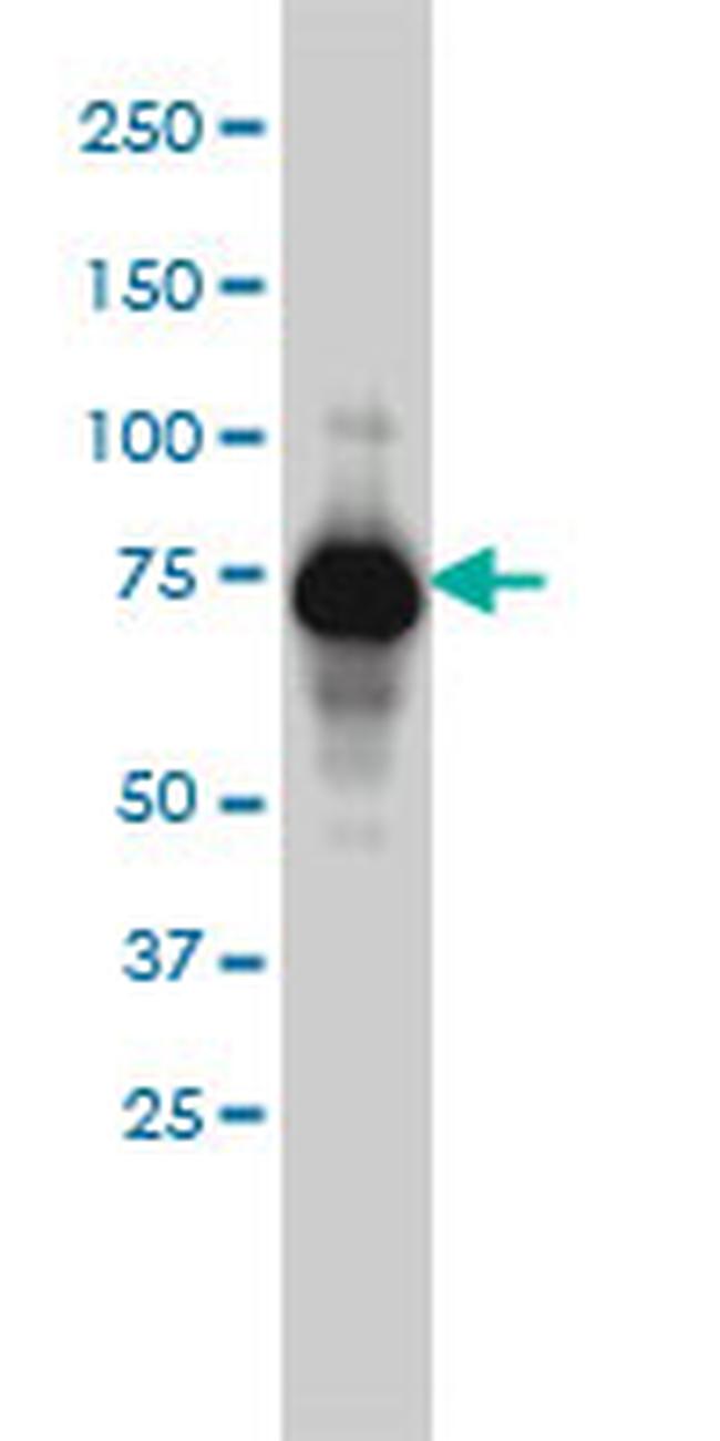 ADD1 Antibody (H00000118-M01)