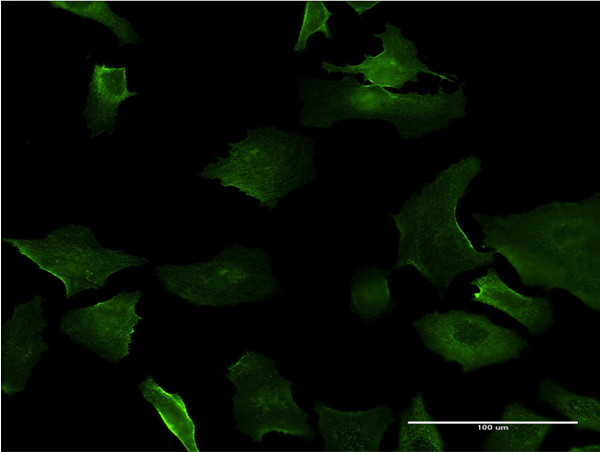 DLX5 Antibody (H00001749-M09)